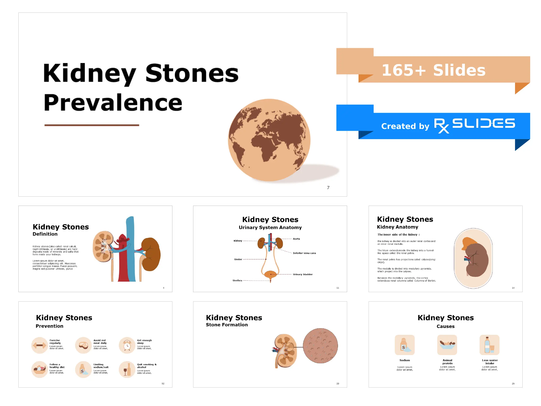 Download kidney Stones PowerPoint Template|RxSlides
